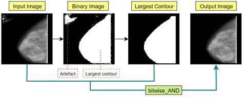 Biology Free Full Text An Effective Ensemble Machine Learning Approach To Classify Breast