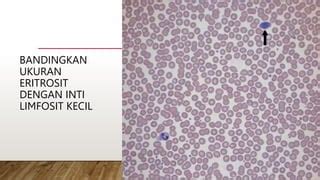 Anemia Def Fe Atau Anemia Inflamasi Pptx