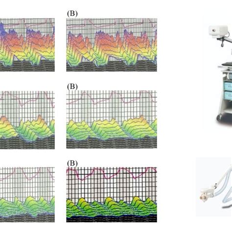 The Forced Oscillation Technique Fot Machine Mostgraph Chest Co Download Scientific