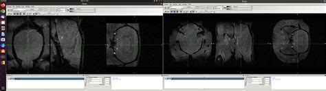 Slicing The Images And Mask In Rbm Rodent Brain Mask Segmentation And Fsl Neuroimaging