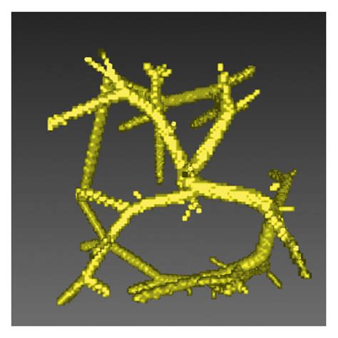 Segmentation Of Vessel From Synthetic Data By Using The Improved Fuzzy