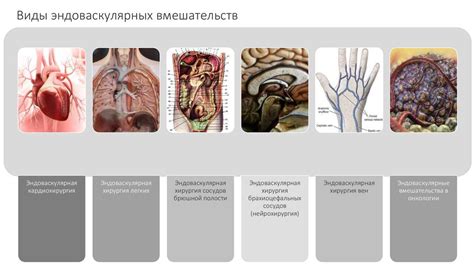 Эндоваскулярная хирургия - презентация онлайн
