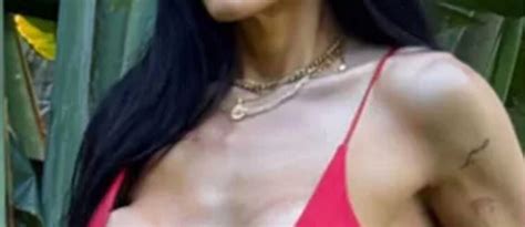 I Survived Two Botched Boob Jobs — Heres Why I Have No Regrets