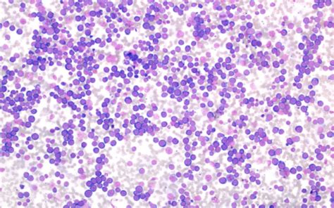 4 Non Regenerative Anemia Flashcards Quizlet