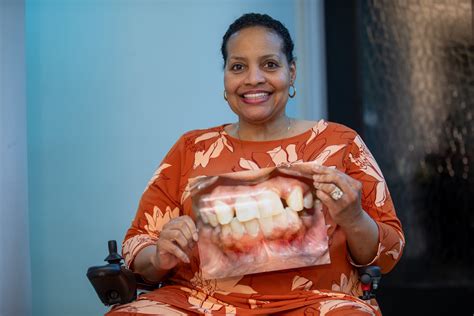 Dental Implant Fixed Bridge