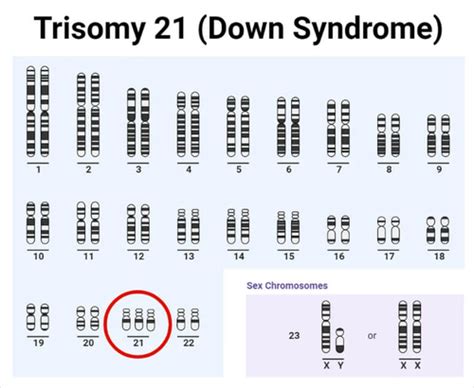 Ibdp Biology Hl Chromosomes And Inheritance Flashcards Quizlet
