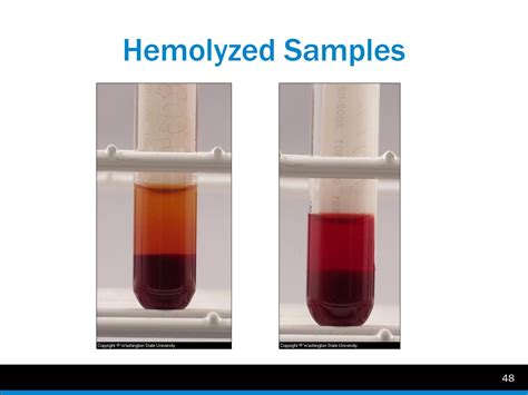 Hematology Collection Ppt Video Online Download