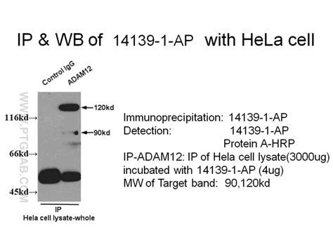Adam12 Fusion Protein Ag5245 Proteintech