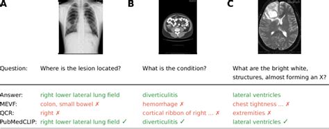 Examples From Vqa Rad Dataset Download Scientific Diagram