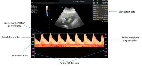 Information — Ultrasound Segmentation Documentation