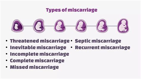 Miscarriage Pptx