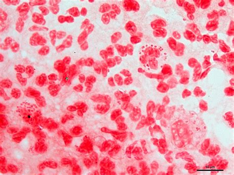 Diplococci Gram Positive