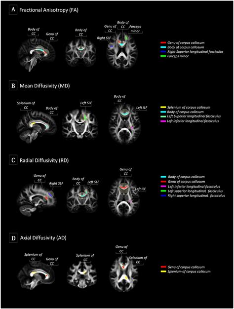 Tract Based Spatial Statistics Tbss Between Superagers And Typical Download Scientific