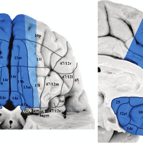 Neural Model Of Conditioned Fear Generalization Following Fear
