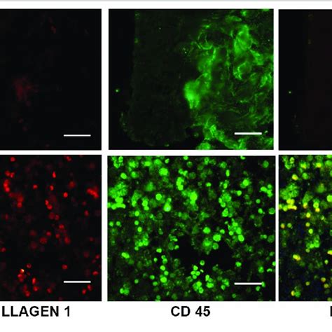 Co Localization Study With Cd45 And Collagen Type I Antibodies At Day