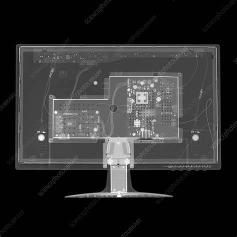 Computer Monitor X Ray Stock Image F030 6966 Science Photo Library