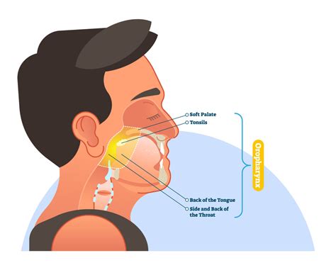 Tonsillectomy Methodist Mckinney Hospital