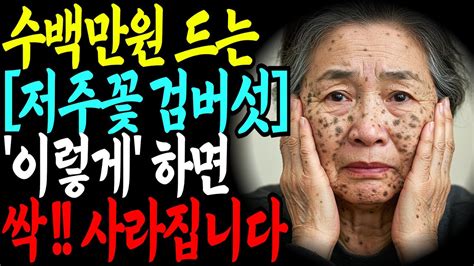 0원으로 집에서 검버섯 없애는 4가지 방법 피부과에 비싼돈 주지마세요 따라만하면 검버섯 기미 싹 사라집니다 검버섯 없애는 좋은 음식 피부관리법 검버섯 검버섯 없애는