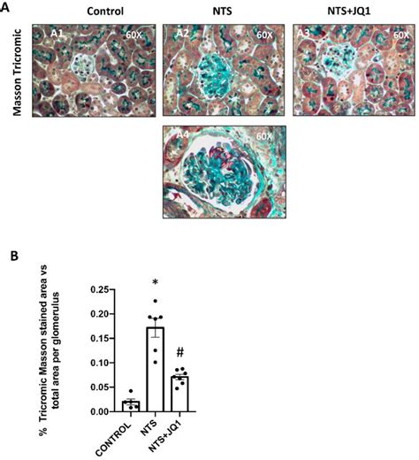 Figure 1 From Type Iv Collagen And Sox9 Are Molecular Targets Of Bet