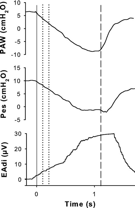 During An Airway Occlusion Patients Inspiratory Effort Is Equally Download Scientific Diagram