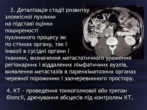 Променева діагностика захворювань шлунково кишкового тракту презентация онлайн