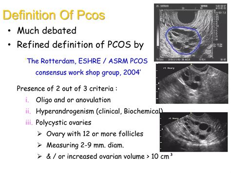 Algorithms For Ovulation Induction Protocols Assisted Reproductive