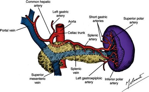 Splenectomy Medical Infographics