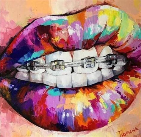 Braces Wallpapers Top Free Braces Backgrounds Wallpaperaccess