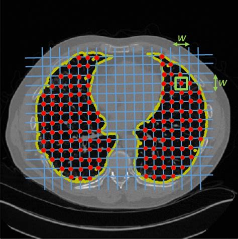 The Schematic Of The Lattice Based Feature Extraction Approach With