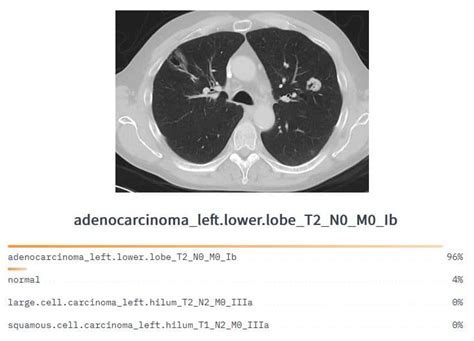 Mastering Image Classification With Cnn And Edge Ai