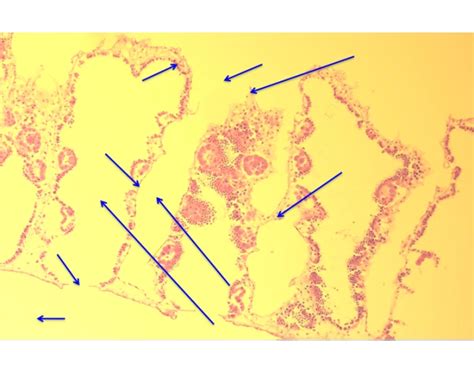 Syconoid Sponge Anatomy Quiz