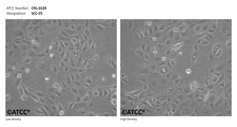 Scc 25 Crl 1628 Atcc