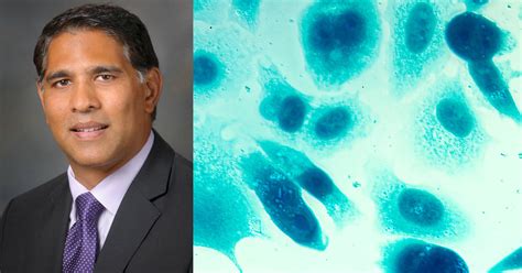 Advances In Immunotherapy For Prostate Cancer With Dr Sumit Subudhi