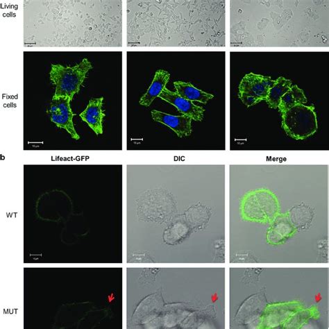 Cell Morphology And Cell Migration Of Hct116 Cells Are Altered By The