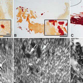 Labral Tissue Morphology Labral Samples Collected From One Download Scientific Diagram