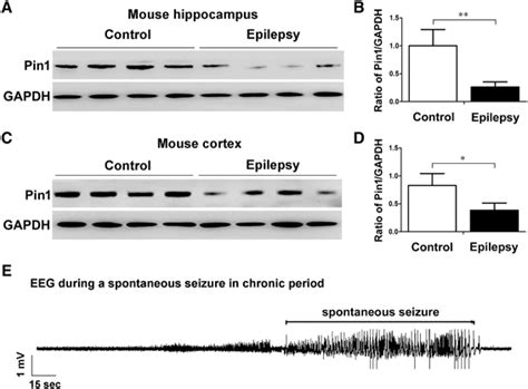 Pin1 Expression In A Pilocarpine Induced Epilepsy Mouse Models The