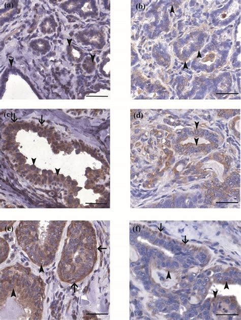 Localization Of Pparα And Ppar In Non Neoplastic Tissue Normal And