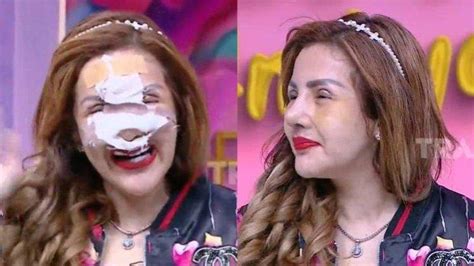 Barbie Kumalasari 9 Kali Jalani Oplas Di Bagian Hidung Tribunlampung