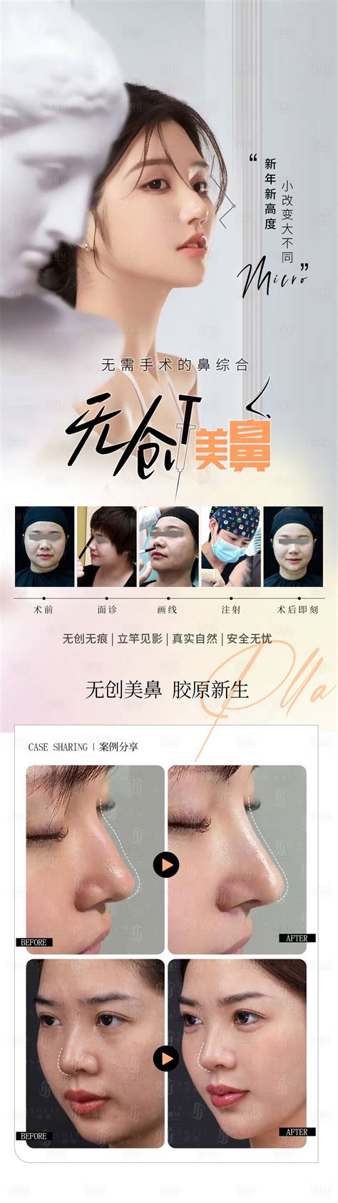 医美玻尿酸填充鼻子海报psd广告设计素材海报模板免费下载 享设计
