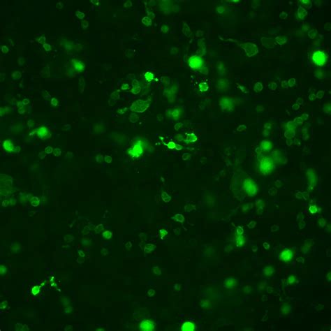 Mouse Tyrobp Cdna Clones Mg53479 Sino Biological