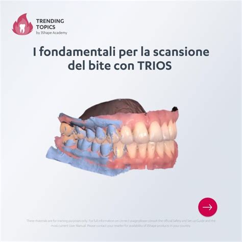 Antonio Russello On Linkedin 3shape Occlusion Bite👌🏼