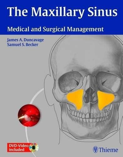 The Maxillary Sinus Medical And Surgical Management Thieme 9781604062809 1604062800