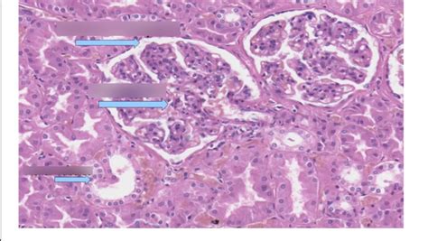 Identify Glomerulus And Bowmans Capsule Diagram Quizlet