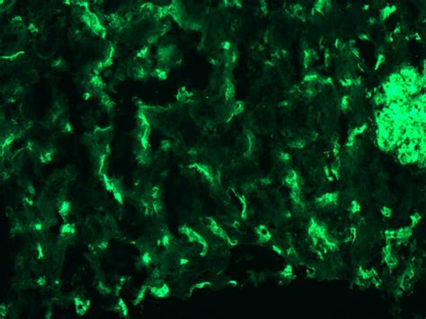 Diffuse C4d Staining Immunofluorescence Method Download Scientific