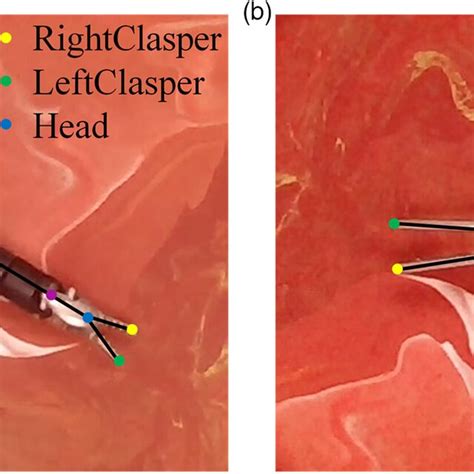 Simulation Results While The Continuum Laparoscope Tracks The Static
