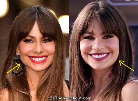 Sofia Vergara Plastic Surgery Comparison Photos