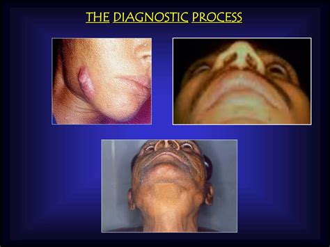 Oral Diagnostic Process Part 1 Ppt