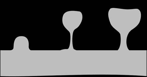 The Three Traditional Types Of Dendritic Spines Download Scientific