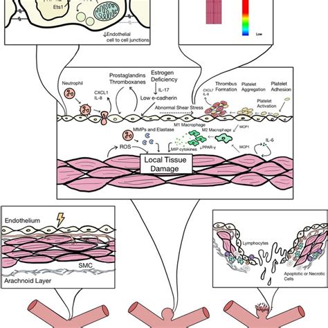 Historical Timeline Of Advancements In Cerebral Aneurysm Diagnosis And Download Scientific