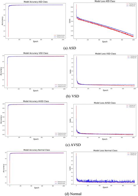 Loss And Accuracy Curve Of Asdvsd Avsd And Normal Heart Download